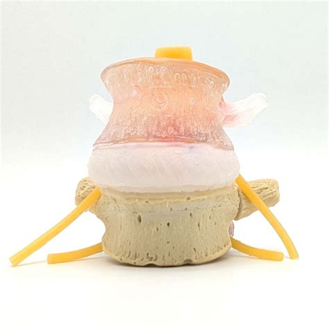 Disc Innervation Model