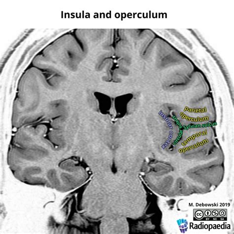 insular cortex fmri