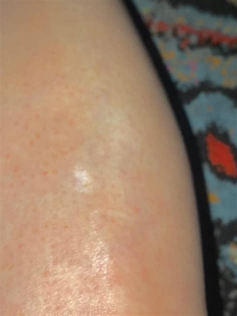 So Found This Its Circular Ralienabduction