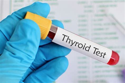What Is a Thyroid Function Test â Uses Importance And How It Helps in Diagnosis