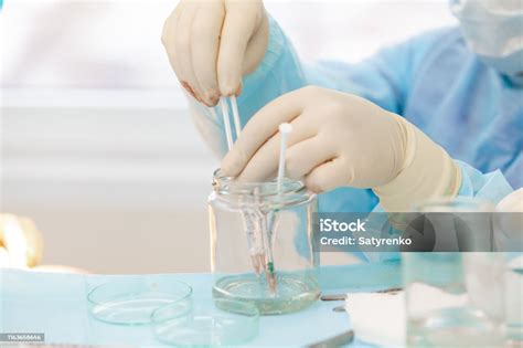 대머리 치료 모발 이식 수술실에서 외과 의사는 모발 이식 수술을 수행합니다 머리의 부분에서 모낭을 이동하는 외과 기술 걱정하는에 대한 스톡 사진 및 기타 이미지 Istock