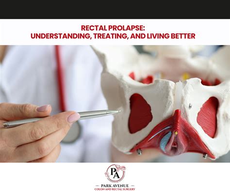 What Is Rectal Prolapse And How It Will Be Cured By Dr What You Need