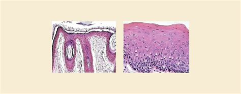 Difference Between Keratinized And Non Keratinized Epithelium Knya