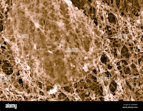 Cell Membrane Raft Coloured And Inverted Transmission Electron Micrograph Tem The Mass At