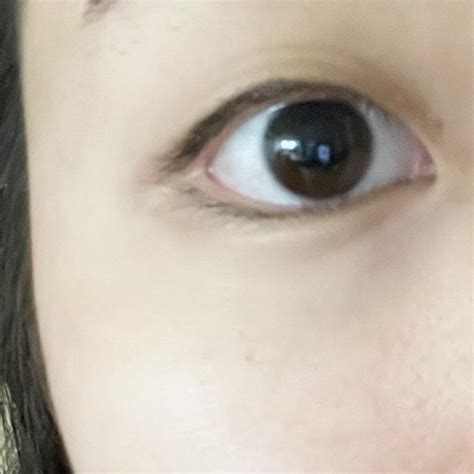 의사에게 물어보세요 방학때 쌍수 예정인 강남언니 1등 성형수술and피부시술 정보앱