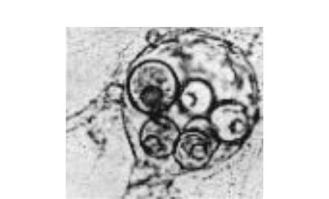 Achlya Proliferoides Sex Organs At Control Showing Eccentric Oospores Download Scientific Diagram Achlya Proliferoides Sex Organs At Control Showing Eccentric Oospores Download Scientific Diagram