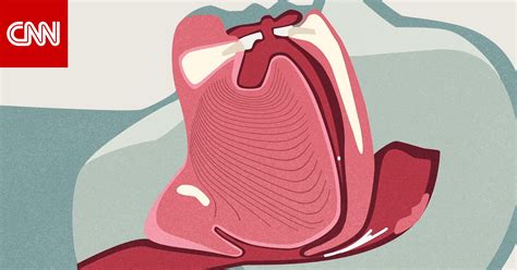 Understanding Sleep Apnea Causes Symptoms And Treatment Options Archyde
