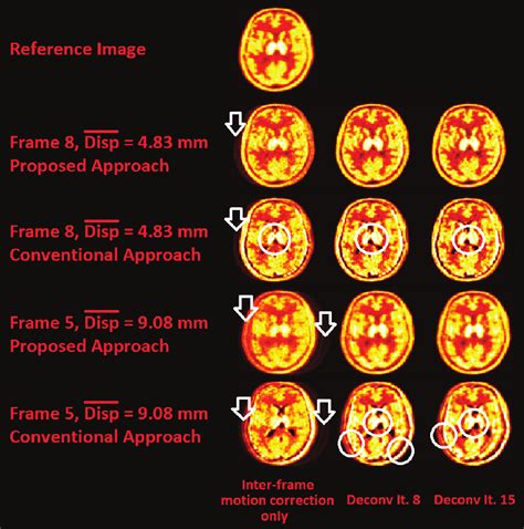 L To R Inter Frame Motion Compensated Images Inter Frame And Download Scientific Diagram