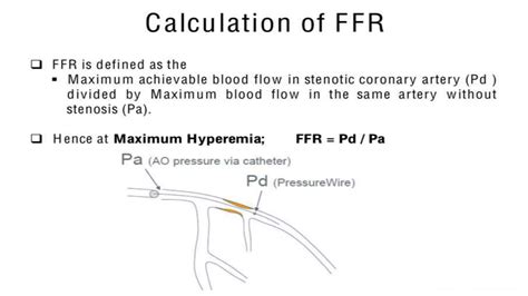 Ffrfractional Flow Reserve Pptx