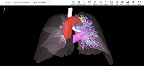 医学影像建模 医疗三维重建对于精准肺结节手术的意义 知乎