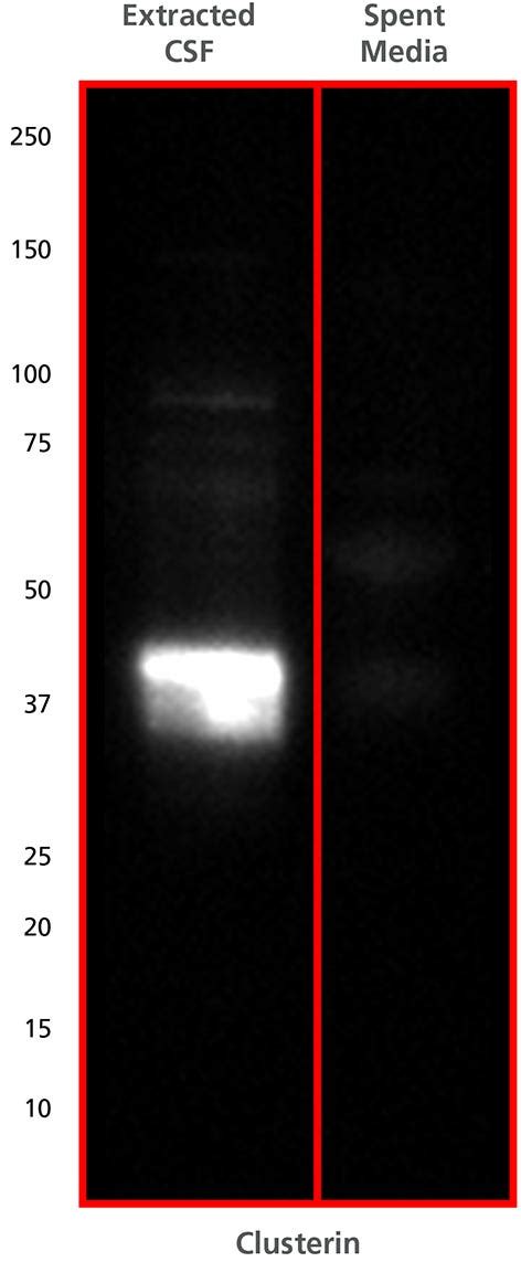 STEMdiff Choroid Plexus Organoid Maturation Kit STEMCELL Technologies