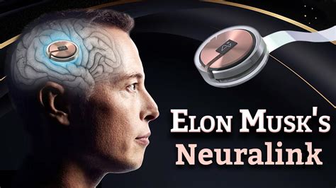 Neuralink Revolutionizing The Future Of Brain Computer Interfaces