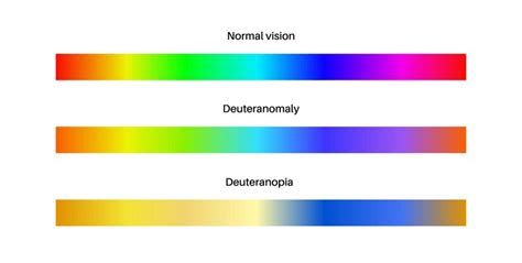 Premium Vector Deuteranomaly And Deuteranopia