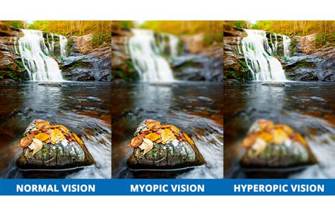 Swarup Eye Centre Premier Eye Care Services In Hyderabad