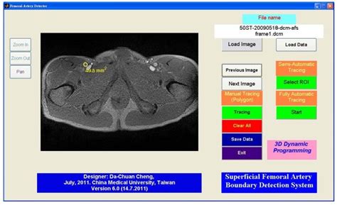 The software system GUI. The system can read DICOM and other image... | Download Scientific Diagram