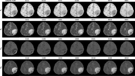 Figure 1 From Missing Mri Pulse Sequence Synthesis Using Multi Modal Generative Adversarial