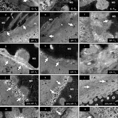 Dentin Microstructure Of Cross Sections From The Middle Of The Bulk Of