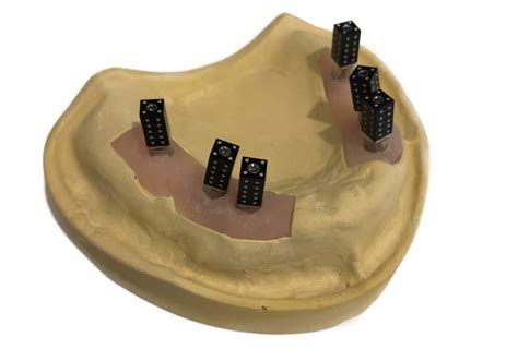 Photogrammetry Group Optical Markers Placed On Implant Abutment Download Scientific Diagram