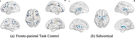 Edges Associated With Sips Or Psychosis Variables Within Download