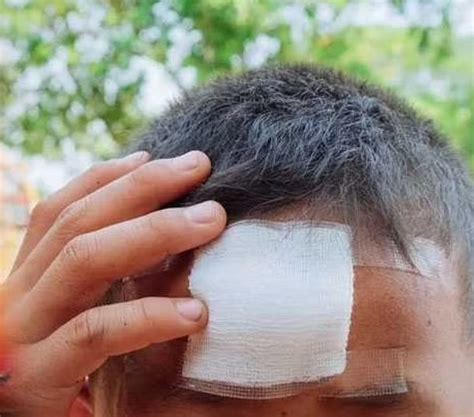 ವದಯರಥ ತಲಗ ಹಕಕ ಜವಲನ ಭರಚ News Karkala