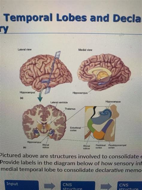 Solved 7 Medial Temporal Lobes And Declarative Memory A