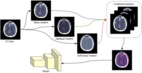 Preprocessing Flow Of A Single Ct Slice In Dicom Format Each Dicom