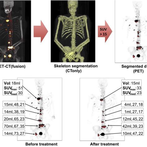 Automatic Segmentation Of Head Ct Dataset Top Segmentation Results Download Scientific