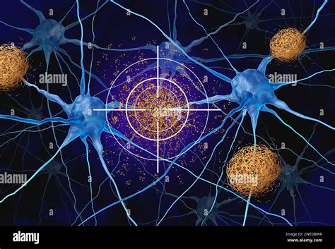 Targeting Amyloid Plaque As A Trgeted Therapy For Plaques Made Of