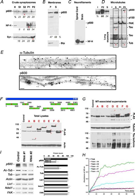 Spatiotemporal Expression Pattern Of P600 In The Mouse Cns A