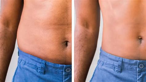 Ultimate Guide To The Best Body Sculpting Treatments For Belly Fat