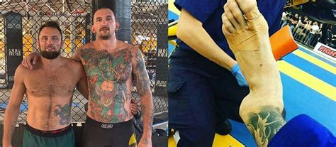 Craig Jones Brother Details Harrowing Leg Break At An Ibjjf Competition That Went Viral