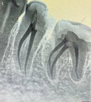 Post Operative Radiograph Download Scientific Diagram