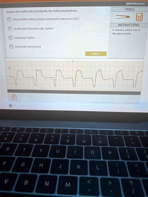 Analyze The Rhythm Strip And Identify The Rhythmdysrhythmia Sinus