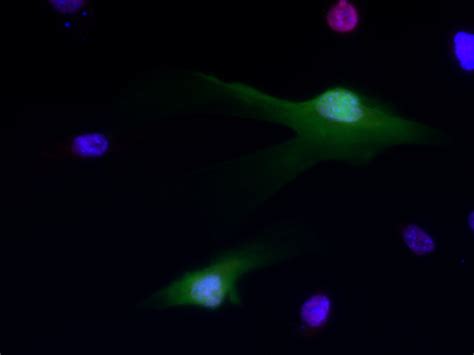 Help With Automatic Object Identification And Background Subtraction Image Analysis Image Sc