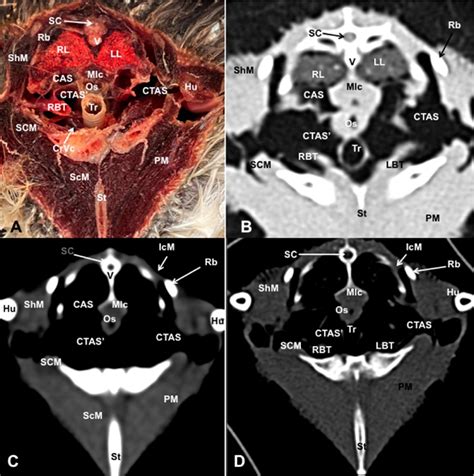Transverse Cross Section Image A Pulmonary B Soft Tissue C And Download Scientific