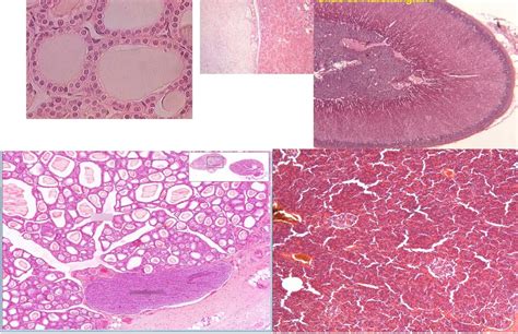 Endocrine System Slides Diagram Quizlet