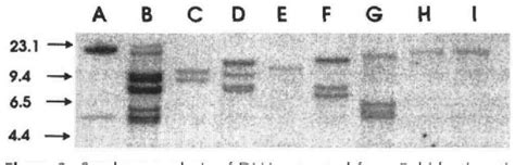 Figure 3 From Antisense Rna Lnhibition Of Rbcs Gene Expression Reduces