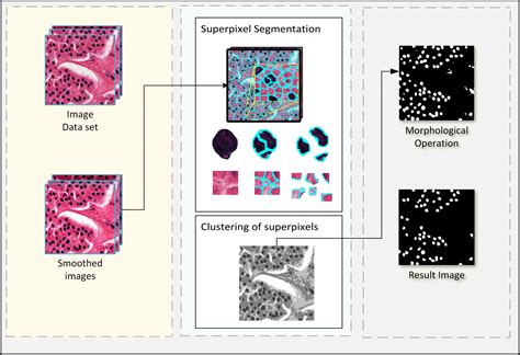 Automatic Cell Segmentation In Histopathological Images Via Two Staged