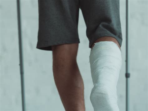 Indemnización Por Fractura De Tibia Y Peroné Abogados Mcp