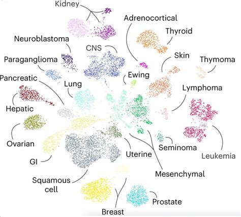 Machine Learning Aided Multiscale Transcriptomics Results In Pediatric Cancer Atlas For