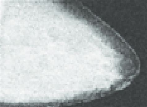 Input Image Figure 2 Noise Removed Image Download Scientific Diagram