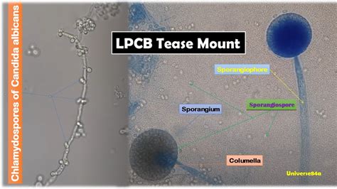 Lpcb Mount Footages Of Various Fungi Introduction List Of Footages And