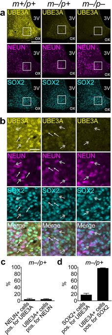 Paternal Ube3a And Sox2 Primarily Colocalize In Neun Negative Cells In Download Scientific