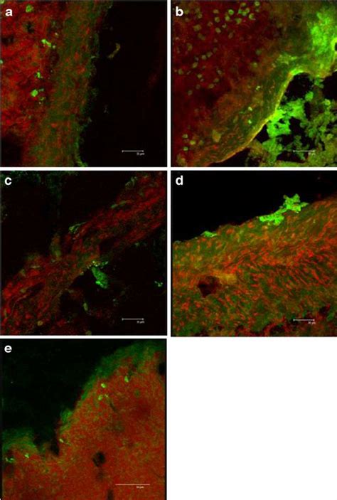 Clsm Microphotographs Of The Duodenum Tissues Treated With A Ps Cs B