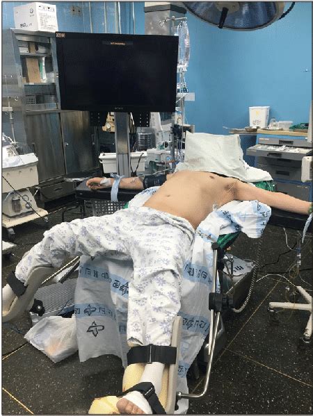 Low Lithotomy Position Fundamentals Of Patient Positioning For Surgery