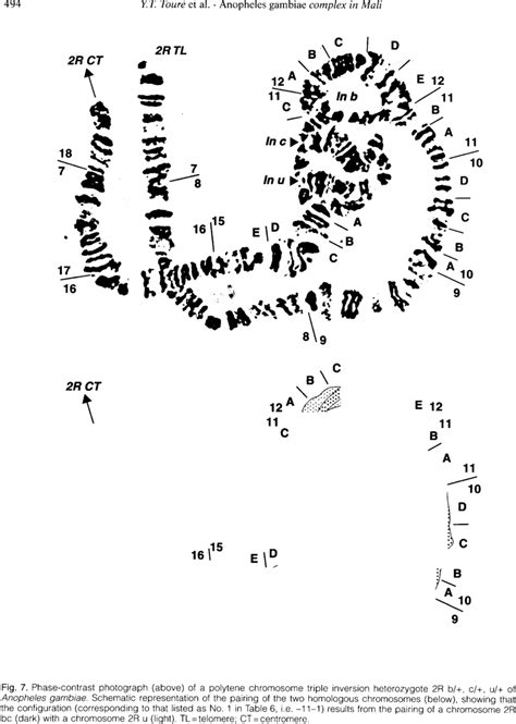 Phase Contrast Photograph Above Of A Polytene Chromosome Triple