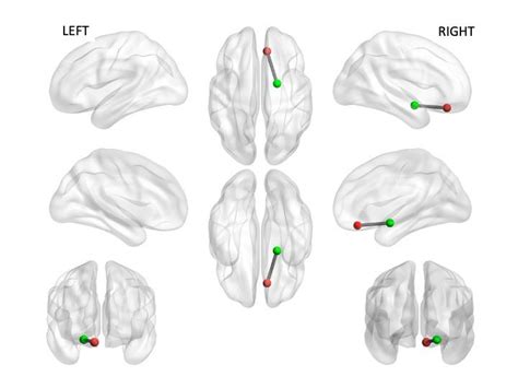 Smartphones Can Accurately Gather Fmri Brain Data Electronics360