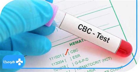 تشخیص بیماریهای خونی با آزمایش CBC Diff پاموه