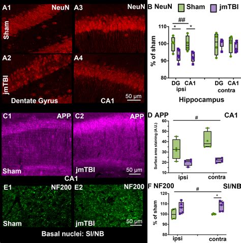 Jmtbi Leads To Hippocampal Neurodegeneration And Sinb Axonal Download Scientific Diagram