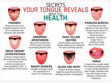 White Bump On The Tip Of My Tongue